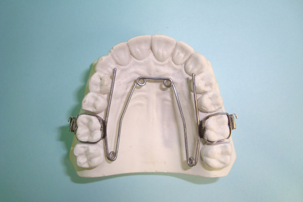 Orthodontic Appliances in Vallejo, Moraga & Pinole, CA | Axelrode ...